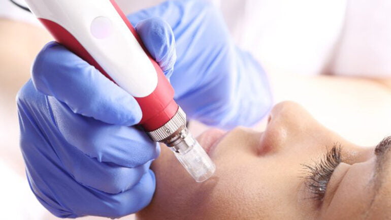 Global Medical Aesthetic Devices :Beautymedicaldevices