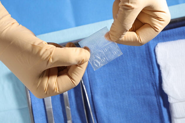 Placental Allografts for Diabetic Foot Ulcers - MiMedx