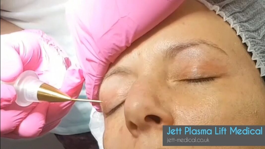 JETT PLASMA EYE-LIFT THERAPY: What Is The Hype All About?