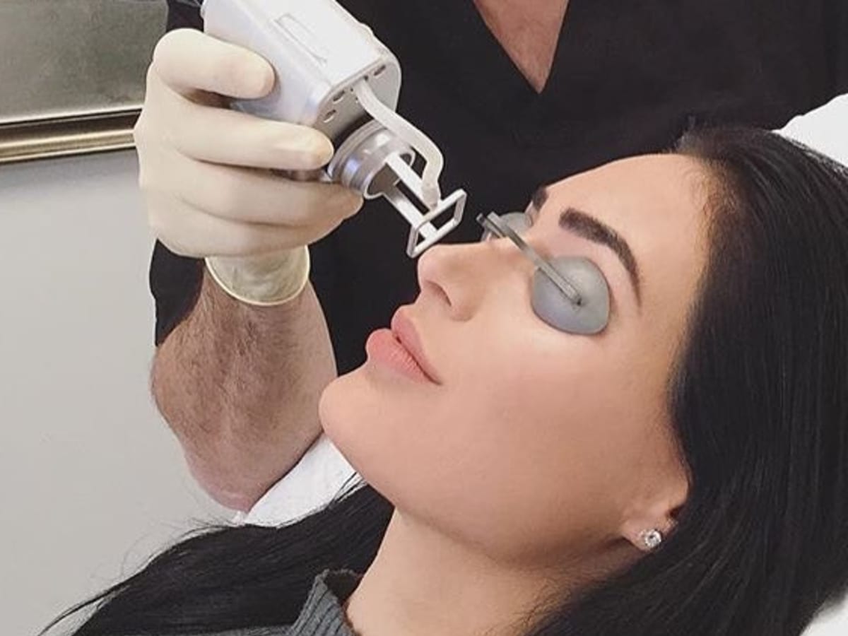 Coolaser Treatment: What You Need to Know About