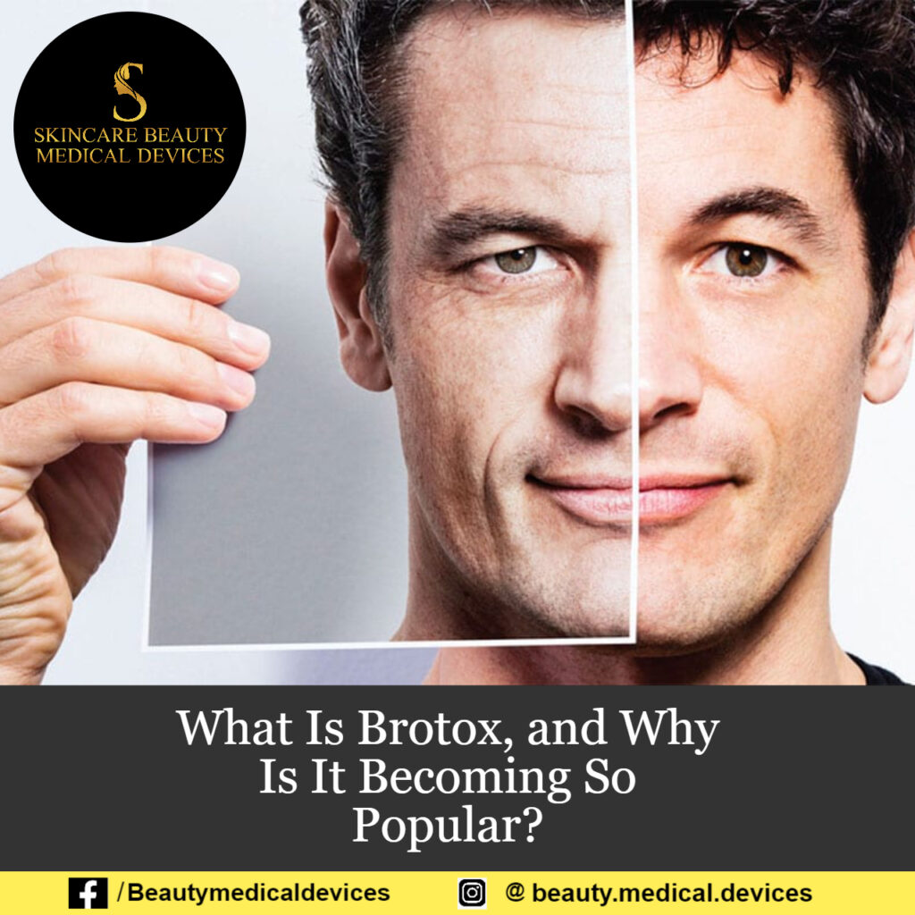 What Is Brotox, and Why Is It Becoming So Popular?