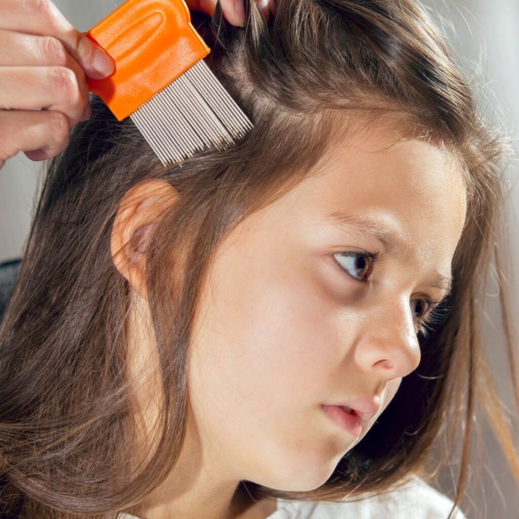 LICE COMB AND HOW YOU SHOULD USE THEM