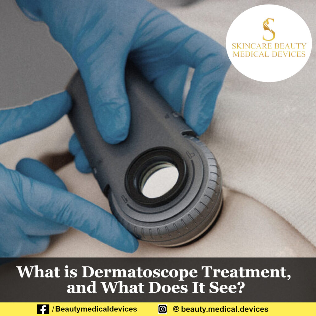 What is Dermatoscope Treatment, and What Does It See?