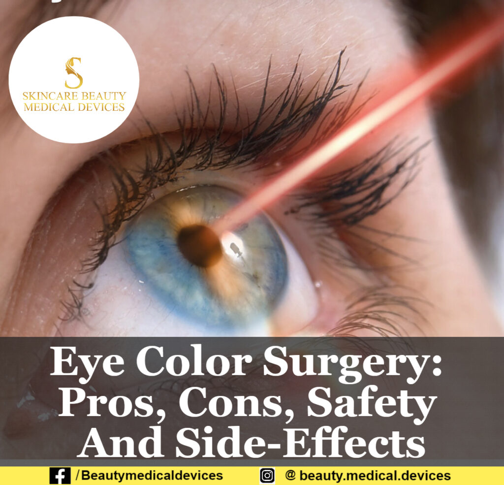 Eye Color Surgery: Pros, Cons, Safety And Side-Effects