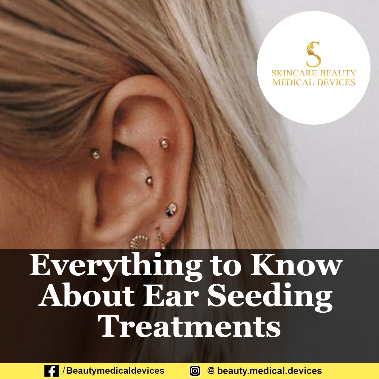 Everything to Know About Ear Seeding Treatments