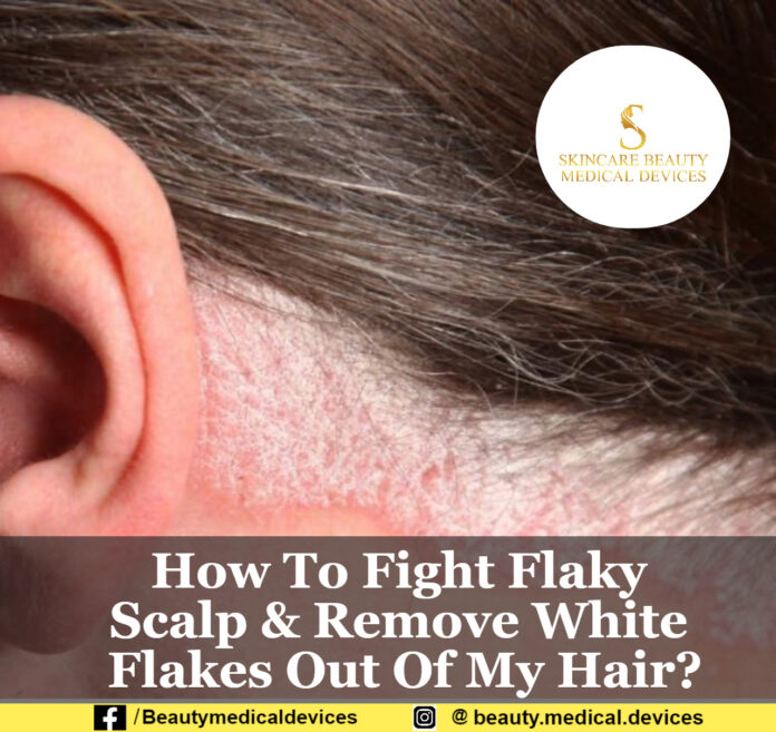 How To Fight Flaky Scalp & Remove White Flakes Out Of My Hair?
