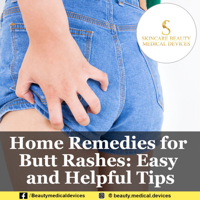 Home Remedies for Butt Rashes: Easy and Helpful Tips