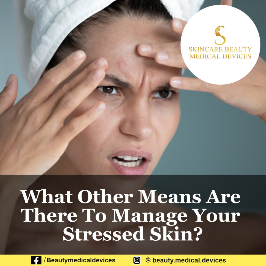 What Other Means Are There To Manage Your Stressed Skin?