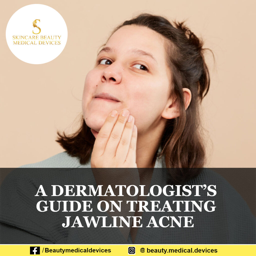 A DERMATOLOGIST’S GUIDE ON TREATING JAWLINE ACNE