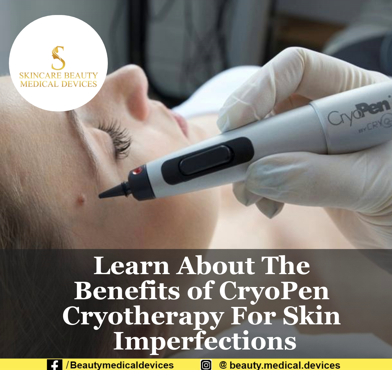 Learn About The Benefits of CryoPen Cryotherapy For Skin Imperfections