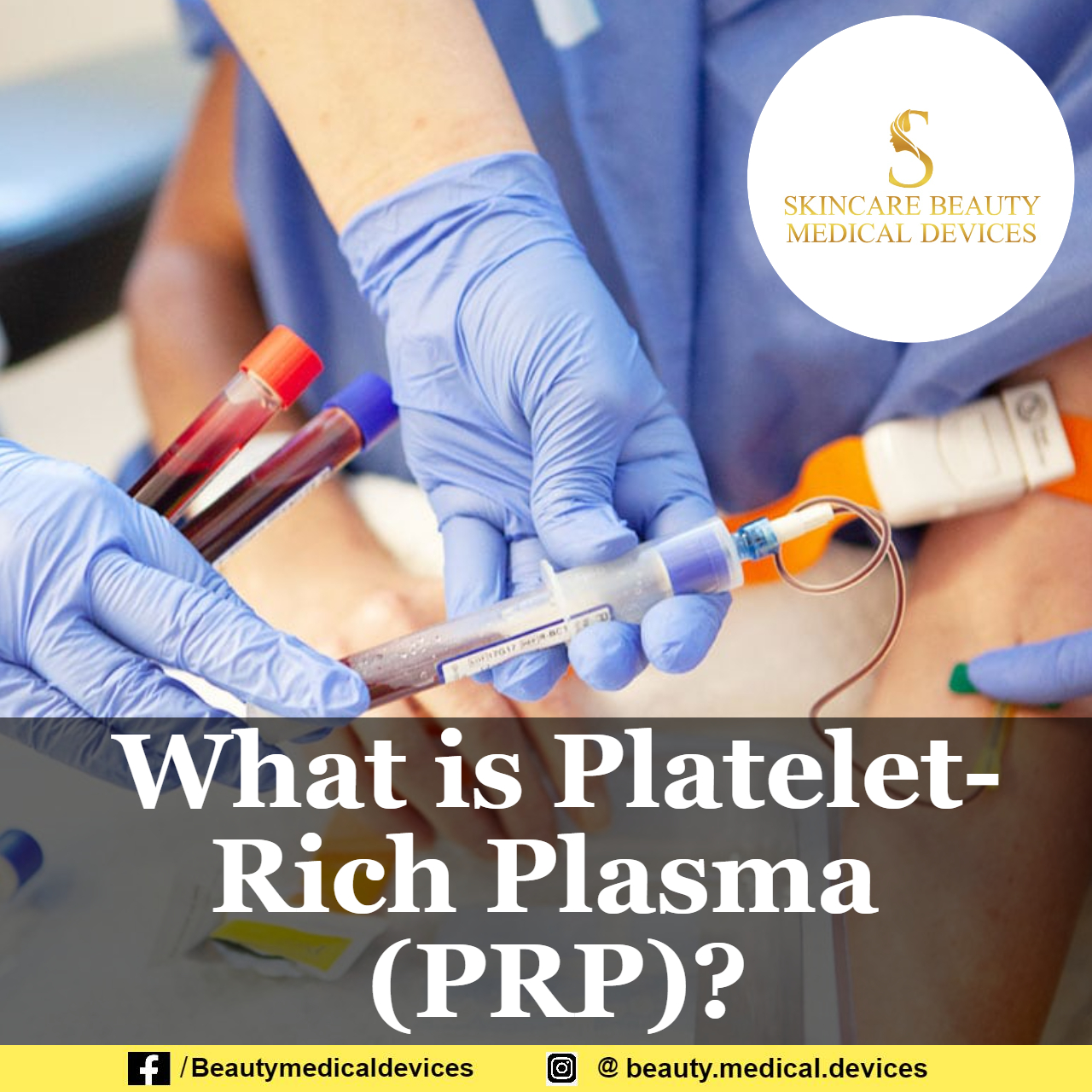 What is Platelet-Rich Plasma (PRP)?