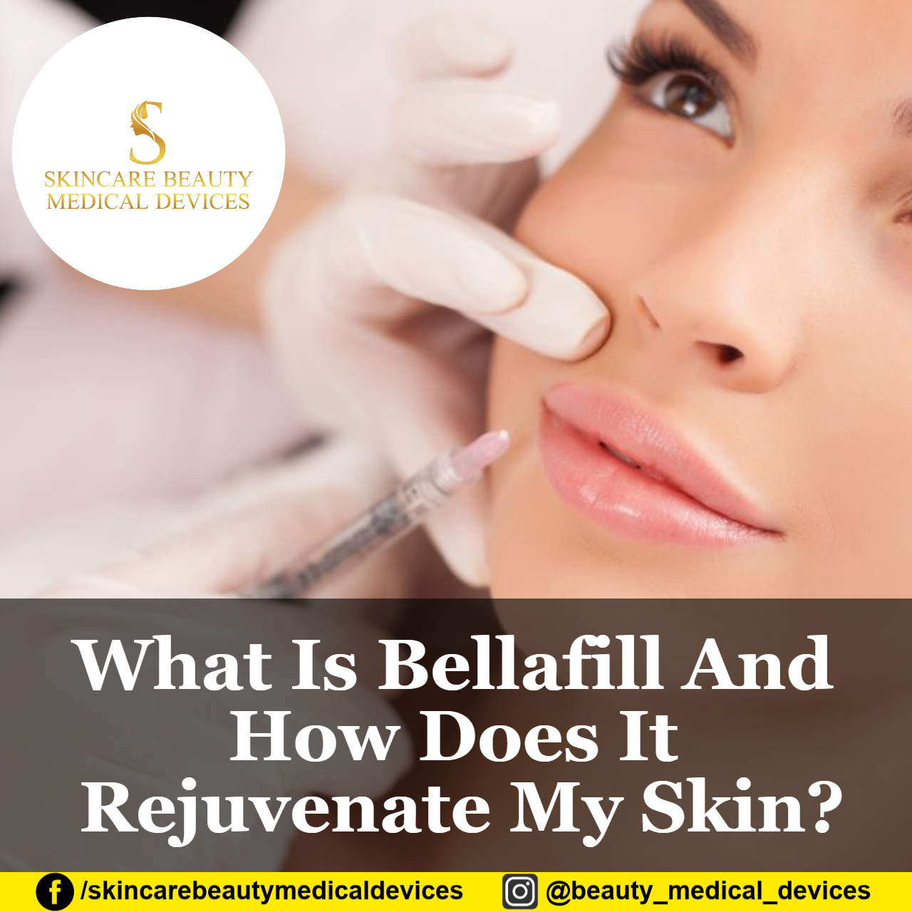 What Is Bellafill And How Does It Rejuvenate My Skin?