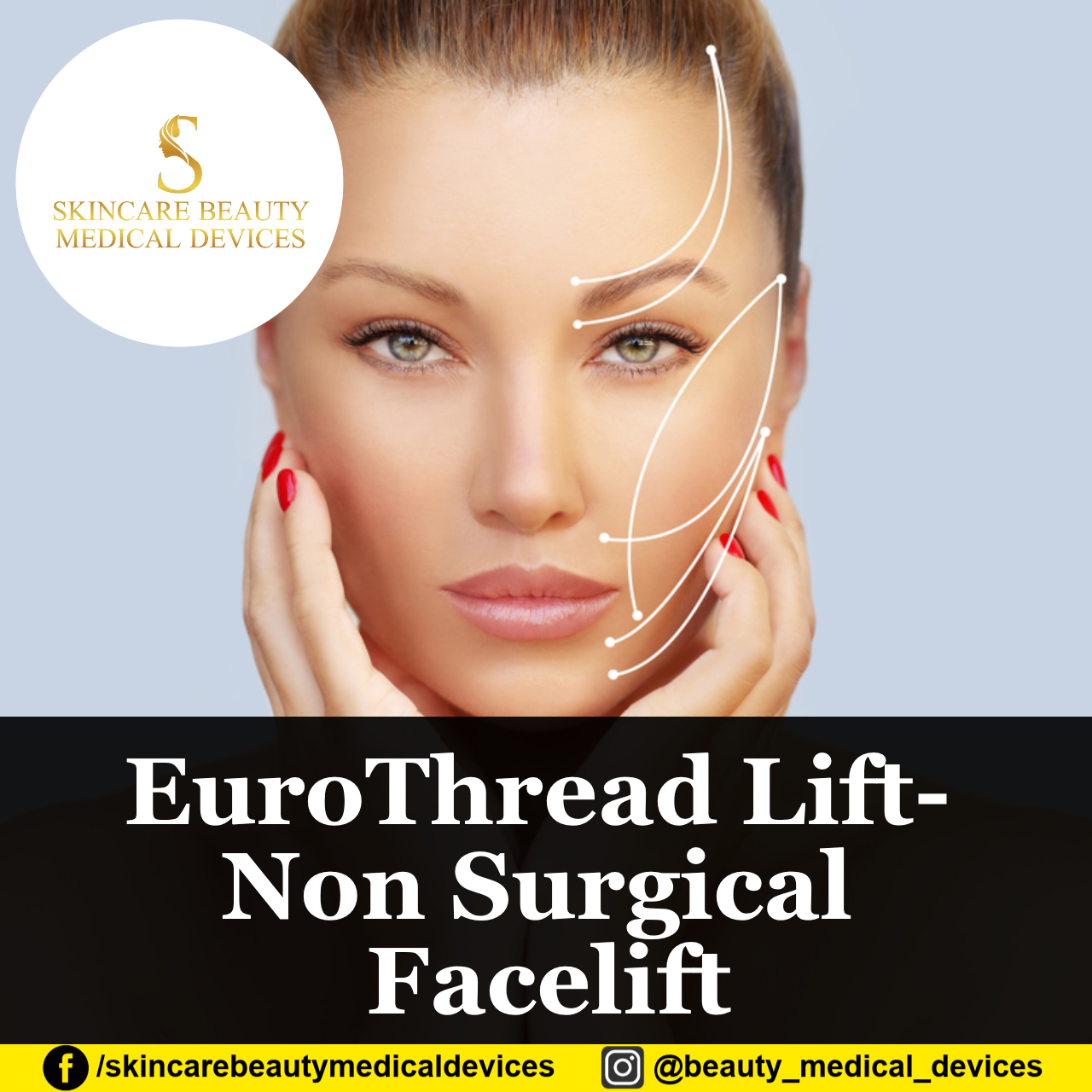 EuroThread Lift- Non Surgical Facelift