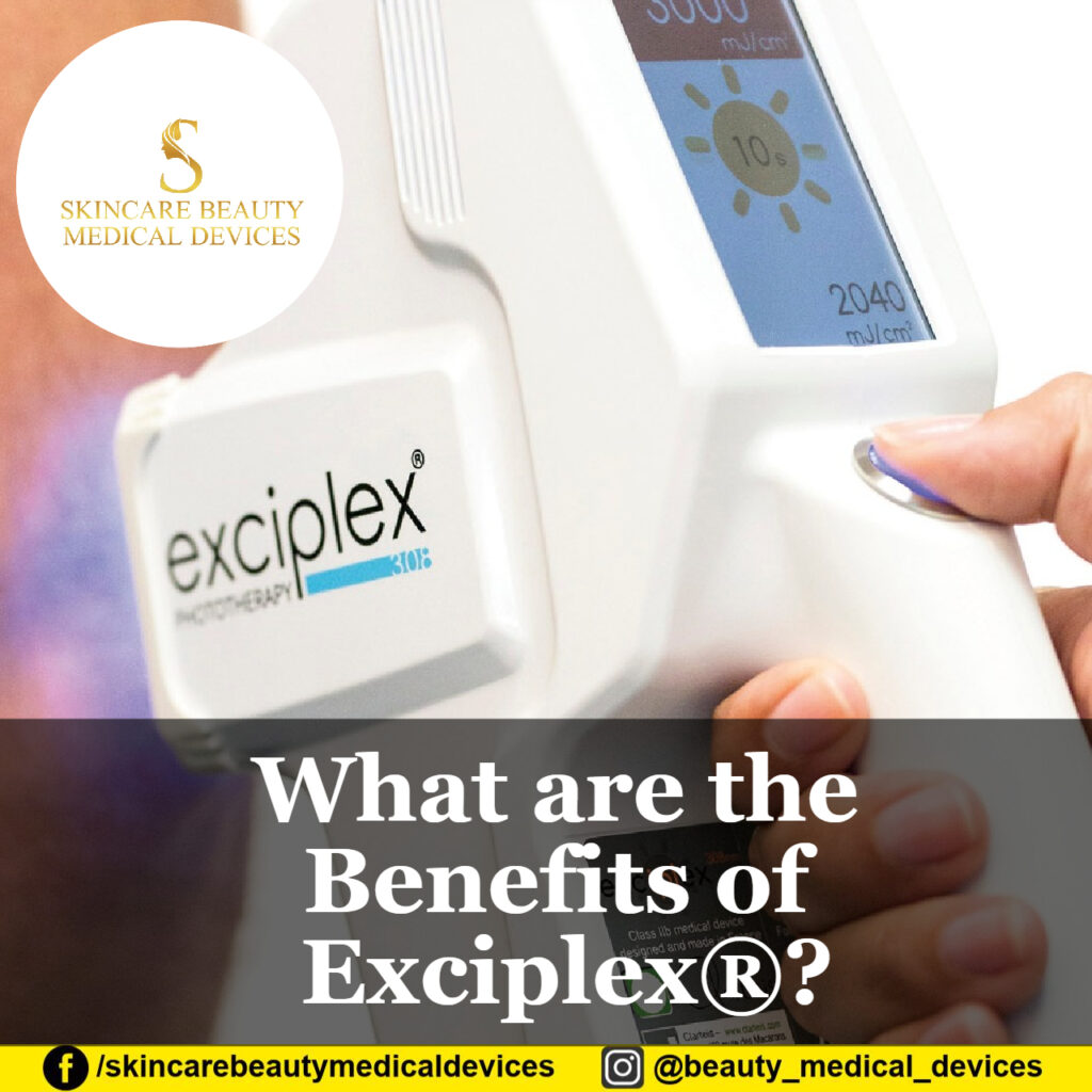 What are the Benefits of Exciplex®?