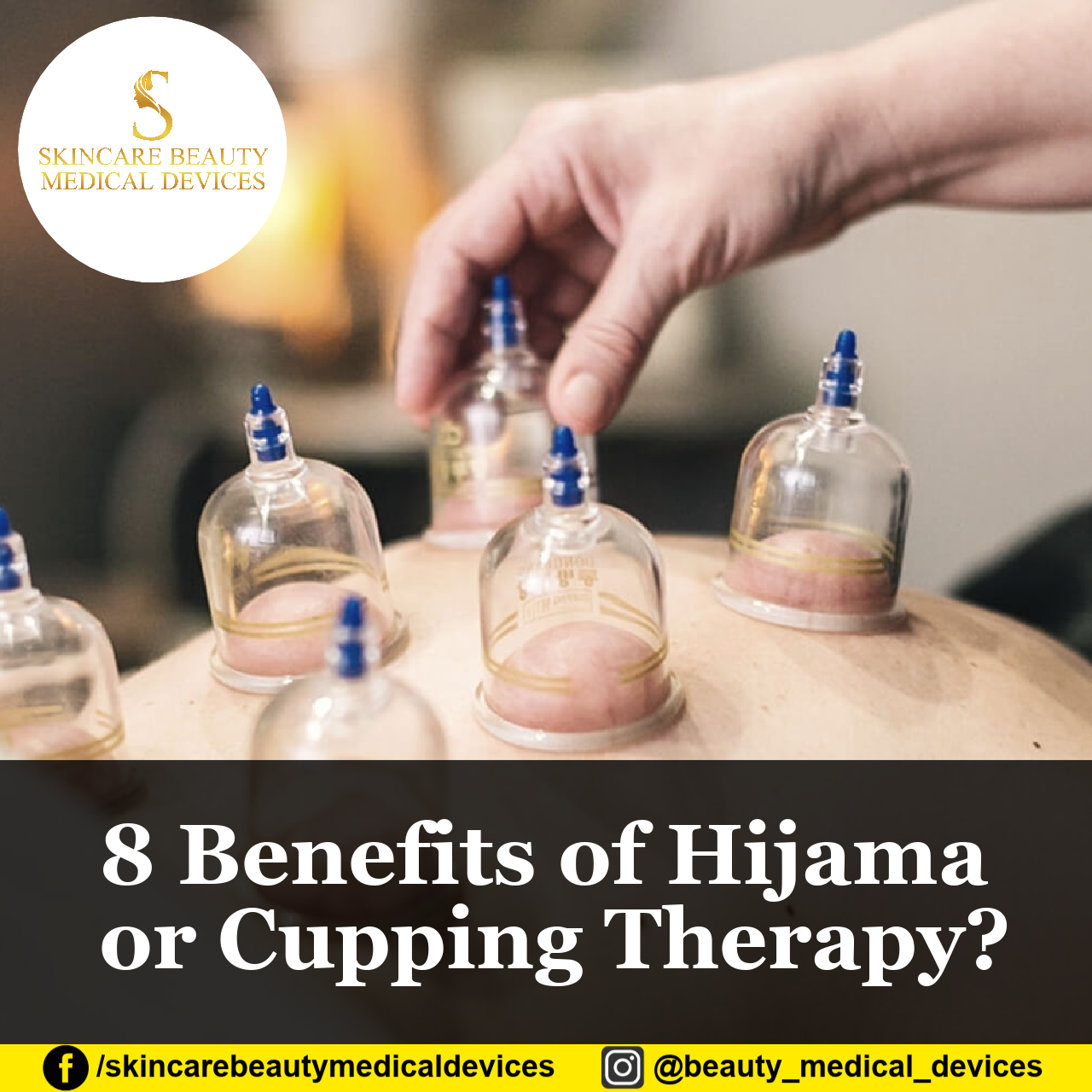 8 Benefits of Hijama or Cupping Therapy?