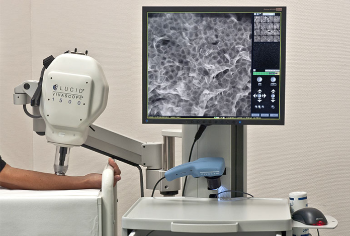 Take A Look Inside Your Skin Cells With Reflectance Confocal Microscopy