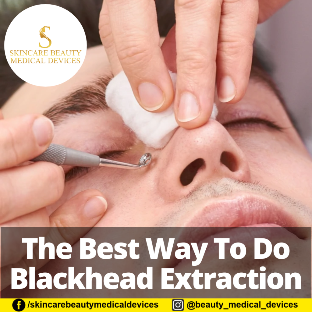 The Best Way To Do Blackhead Extraction