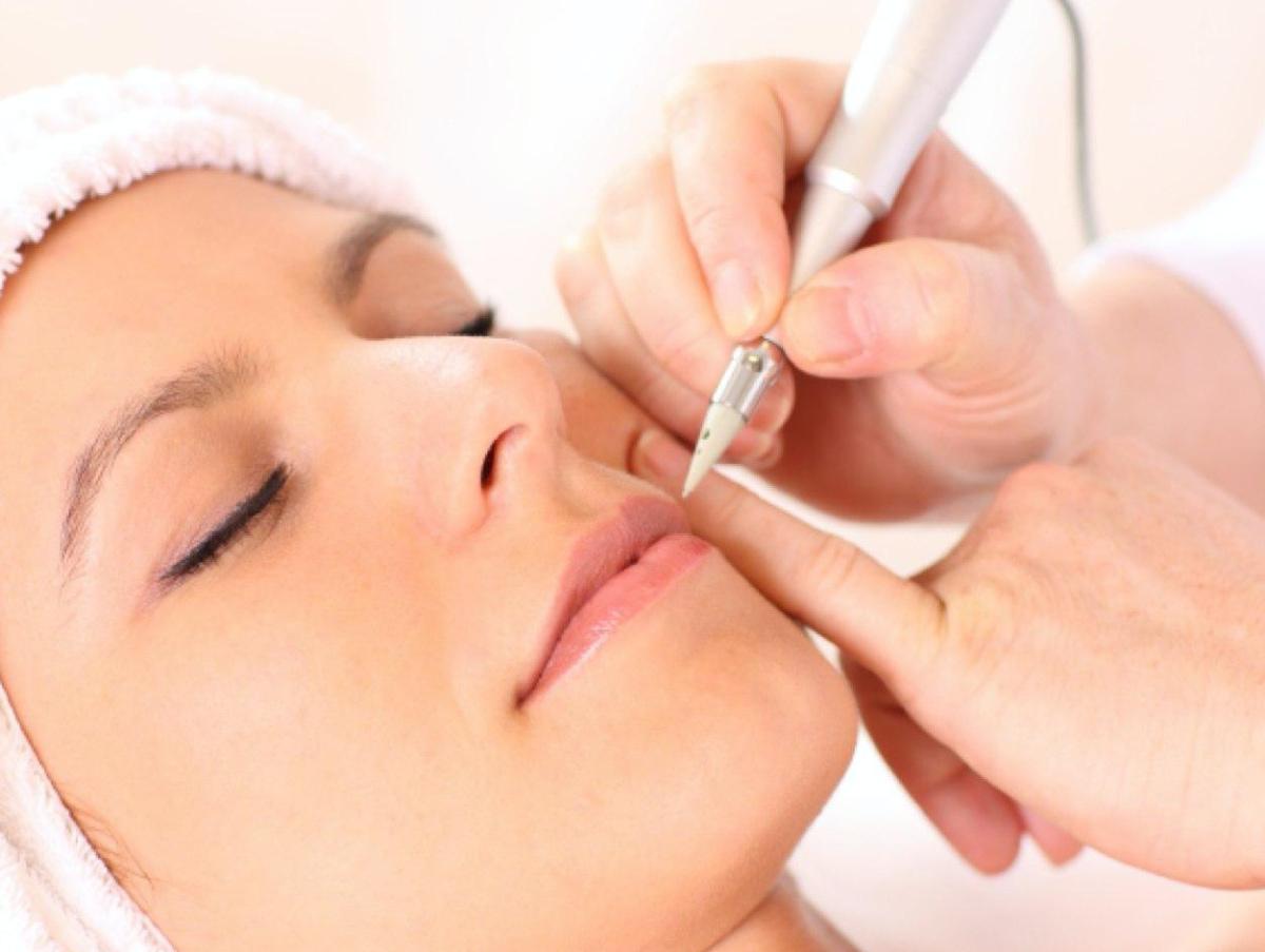 What Is Electrolysis Hair Removal, And Why You Should Consider It