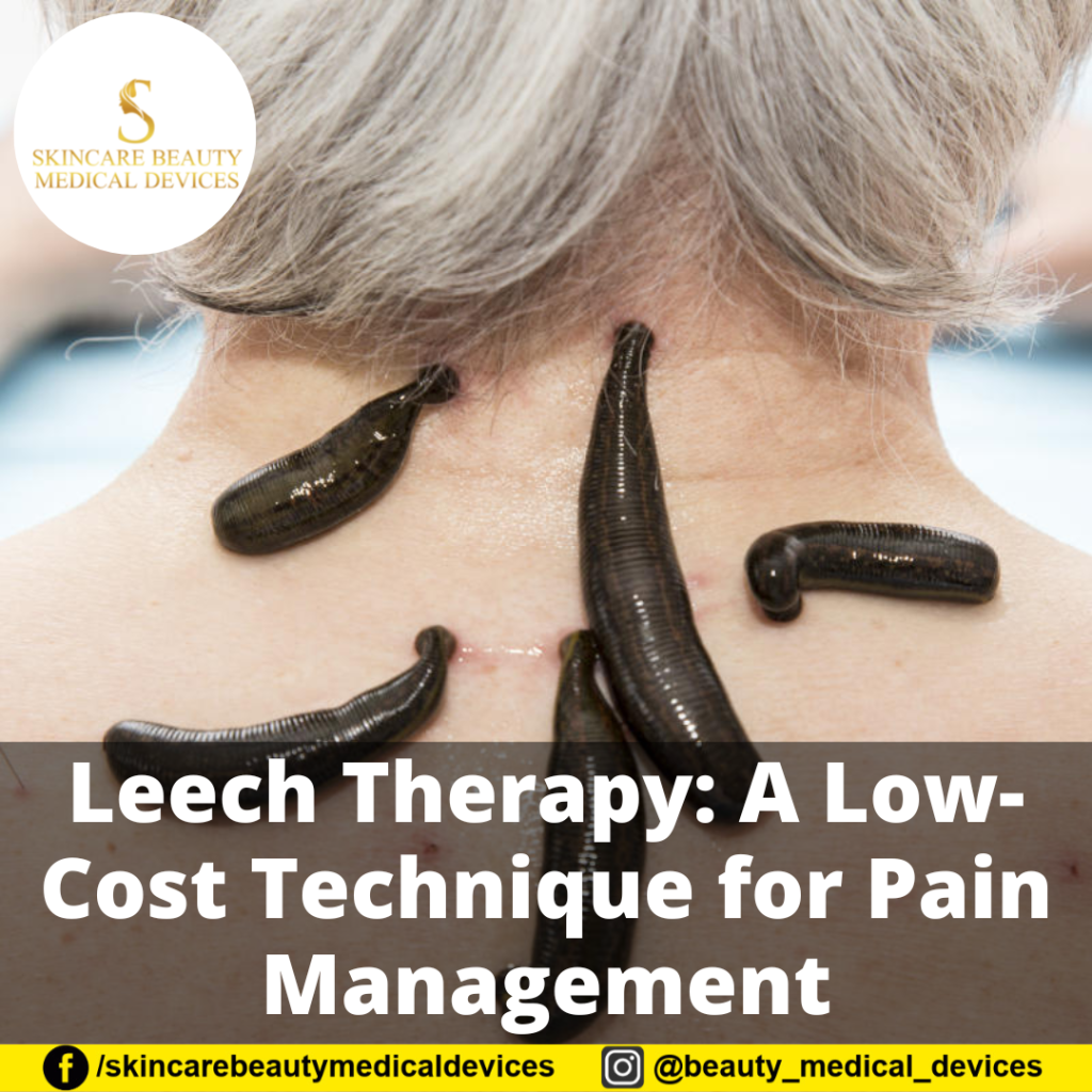 Leech Therapy: A Low-Cost Technique for Pain Management