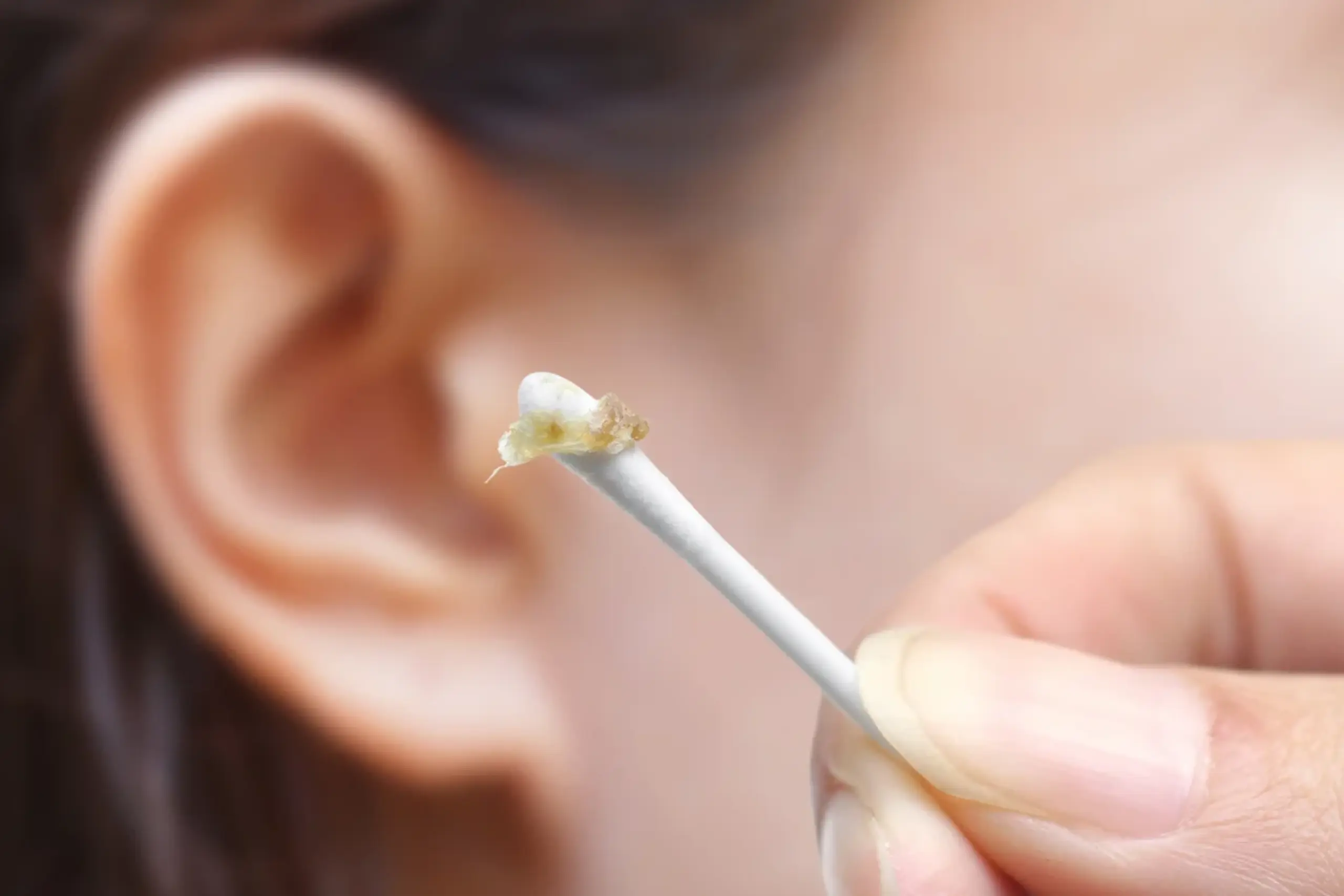 The Lowdown on Ear Wax: What It Is and Why It Matters