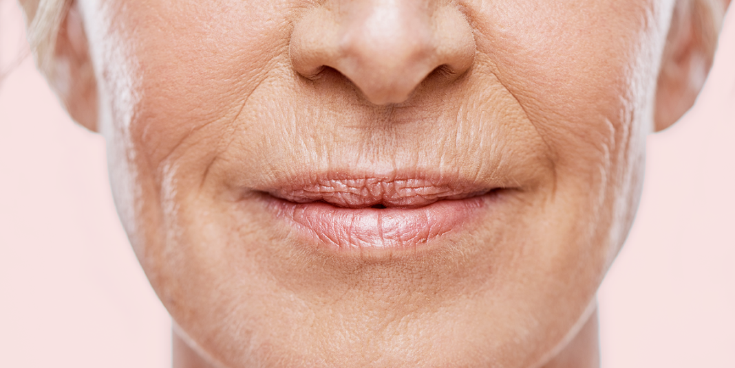 Smooth and Youthful: Effective Ways to Combat Wrinkles Above Lips